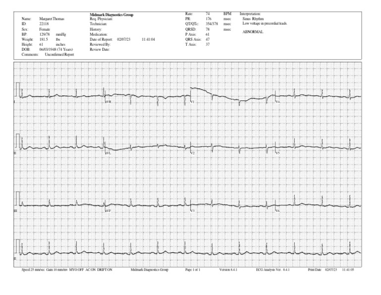 Midmark Diagnostics Group: I aVR V1 V4 | PDF