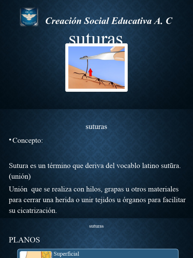 Suturas | PDF | Sutura Quirúrgica