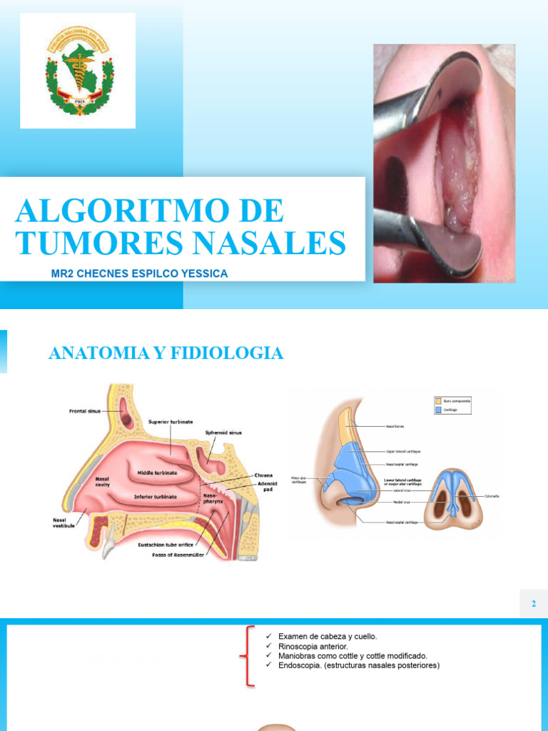 Tumores Nasales ORL YESSICA CHECNES ESPILCO | PDF | Cáncer | Sarcoma