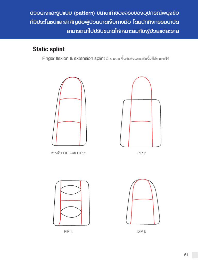 Pattern splint | PDF