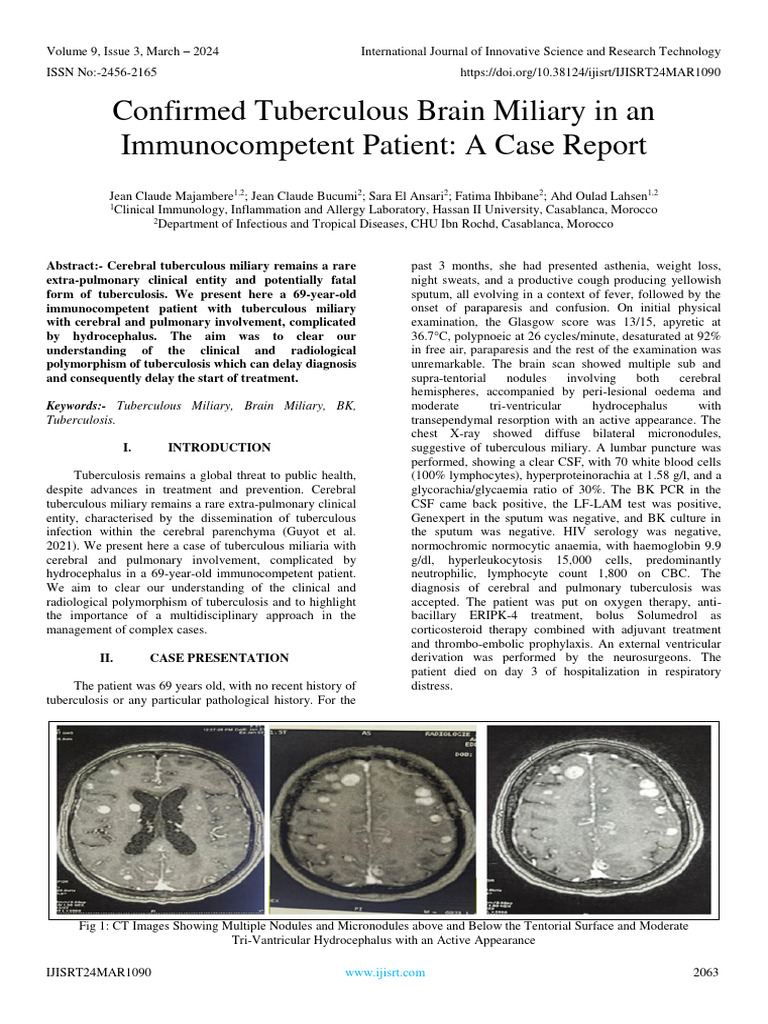 Confirmed Tuberculous Brain Miliary in An Immunocompetent Patient: A ...