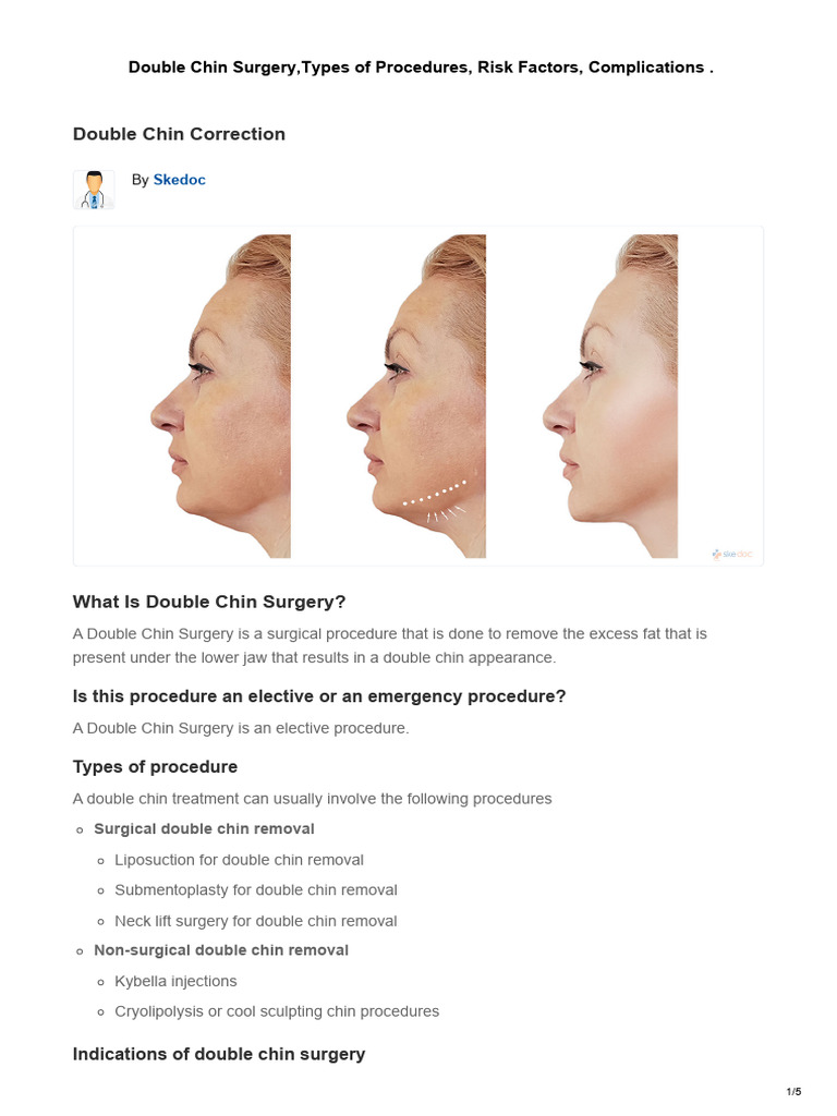 Types of Double Chin Surgery Explained | PDF | Surgery | Plastic Surgery