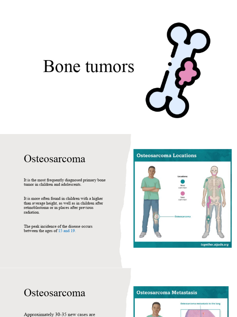 Bone Tumors | PDF | Sarcoma | Cancer