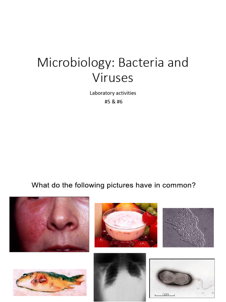 Bacteri Vs Viruses | PDF | Virus | Bacteria