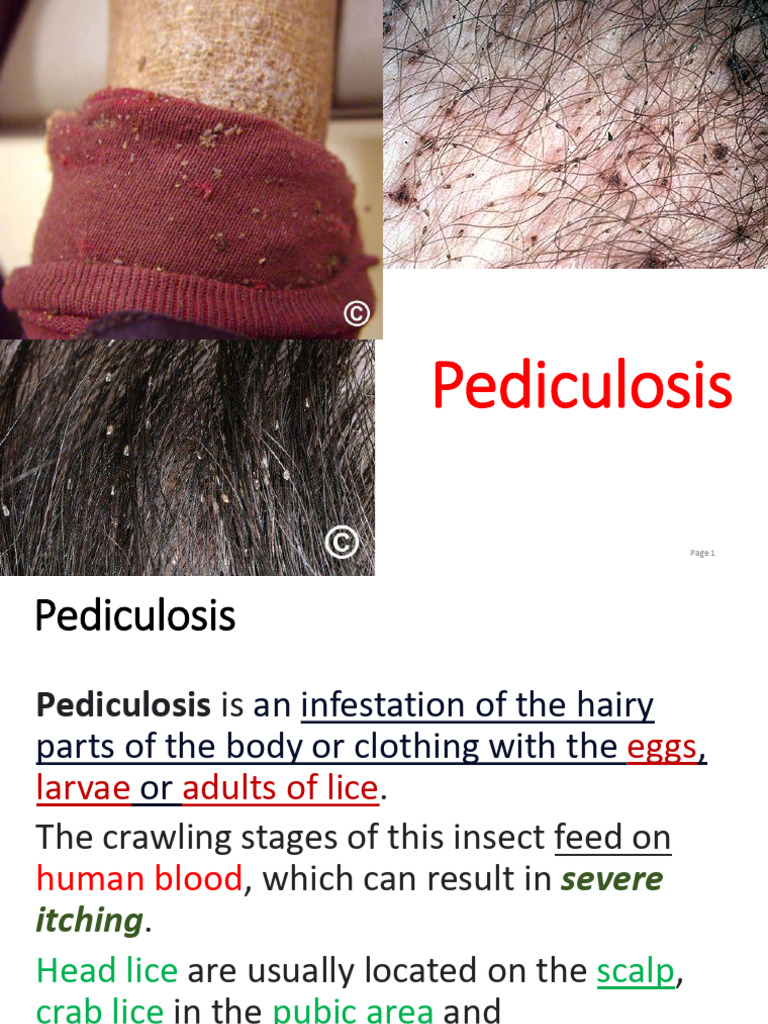 Lesson 8 PEDICULOSIS | PDF | Medical Specialties | Diseases And Disorders