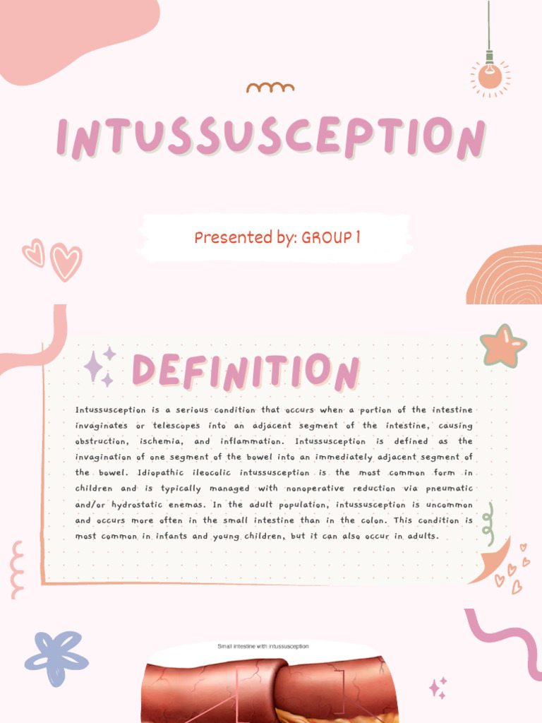 Intussusception | PDF | Medical Specialties | Causes Of Death