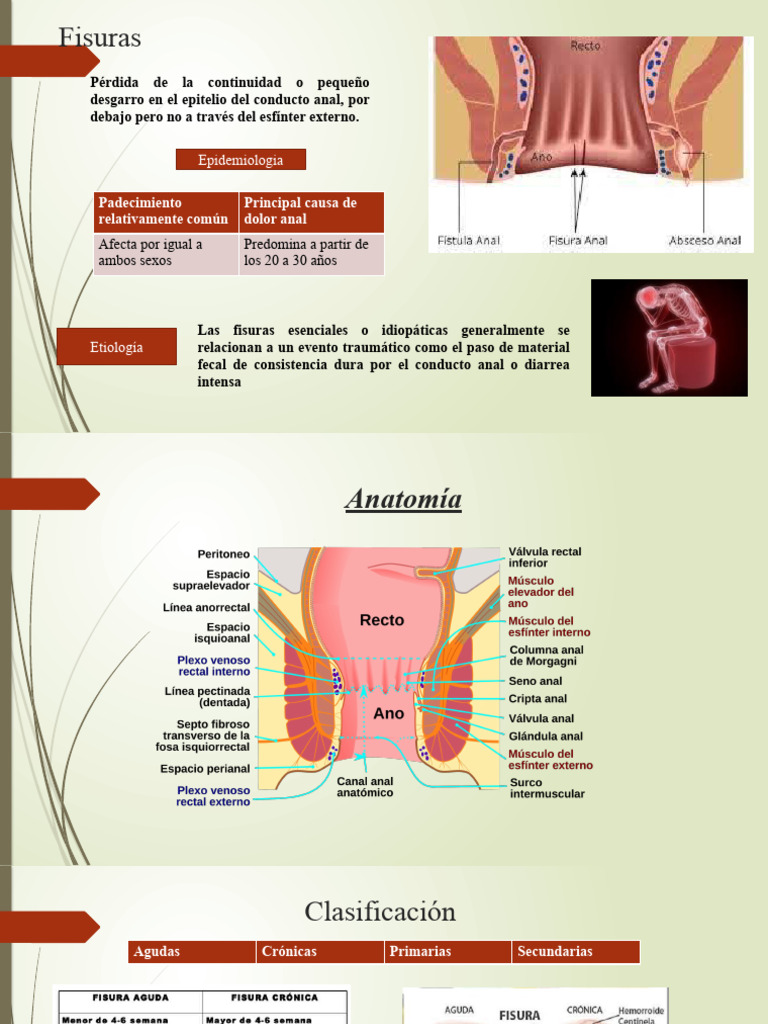 Fisuras y Fistulas | PDF | Heces | Diarrea