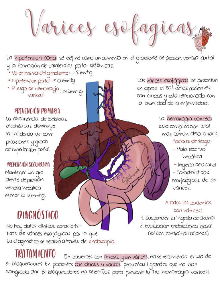Varices Esofagicas | PDF