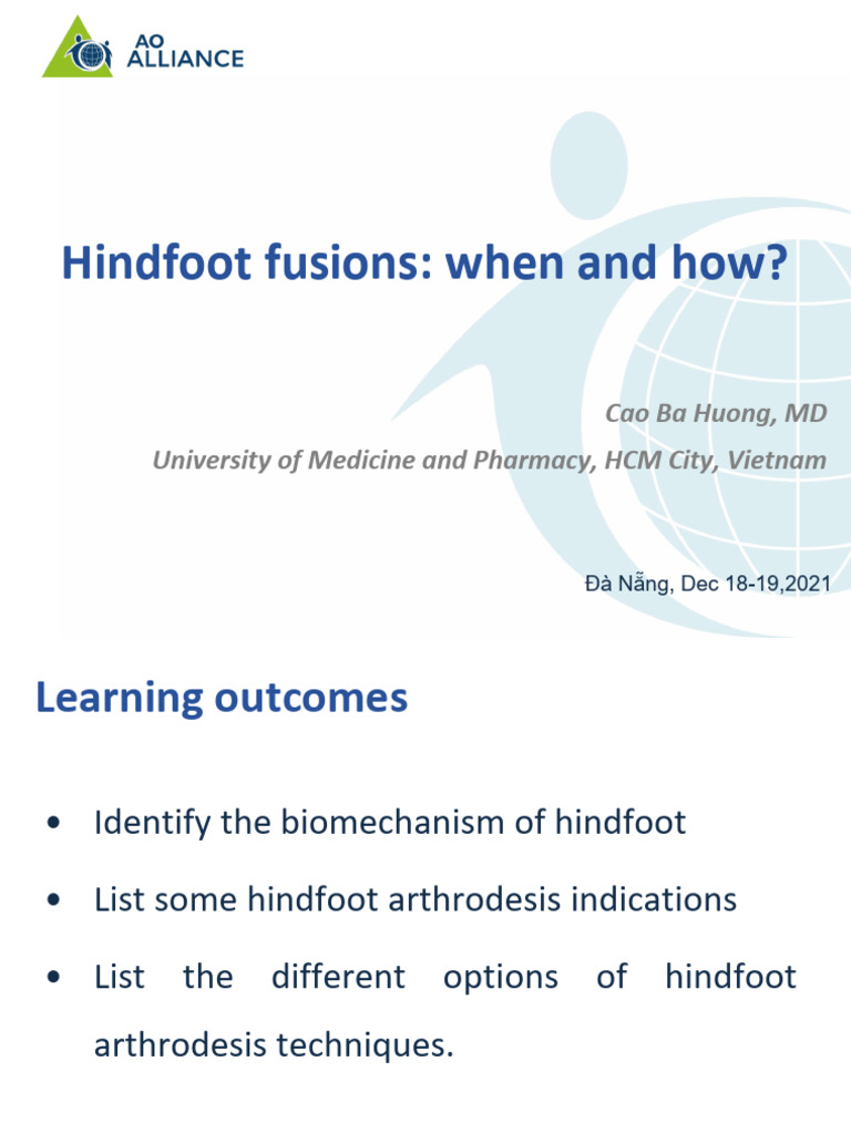 2.15. Hindfoot Fusion-Eddited | PDF | Musculoskeletal System | Lower ...