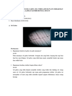 Pembakar Spiritus Dan Fungsinya: Tabung Reaksi, Erlenmeyer Gelas Beaker ...