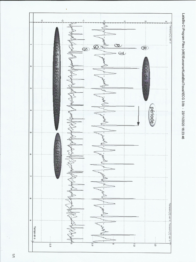 ECG Etude de L'activité Cardiaque | PDF