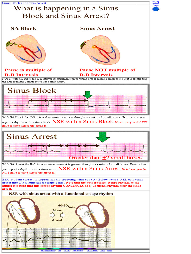 SA Block and Sinus Arrest | PDF | Science & Mathematics