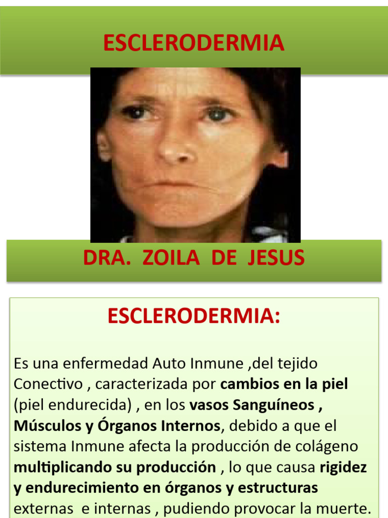 Esclerodermia: Síntomas y Tratamientos | PDF | Especialidades Medicas ...