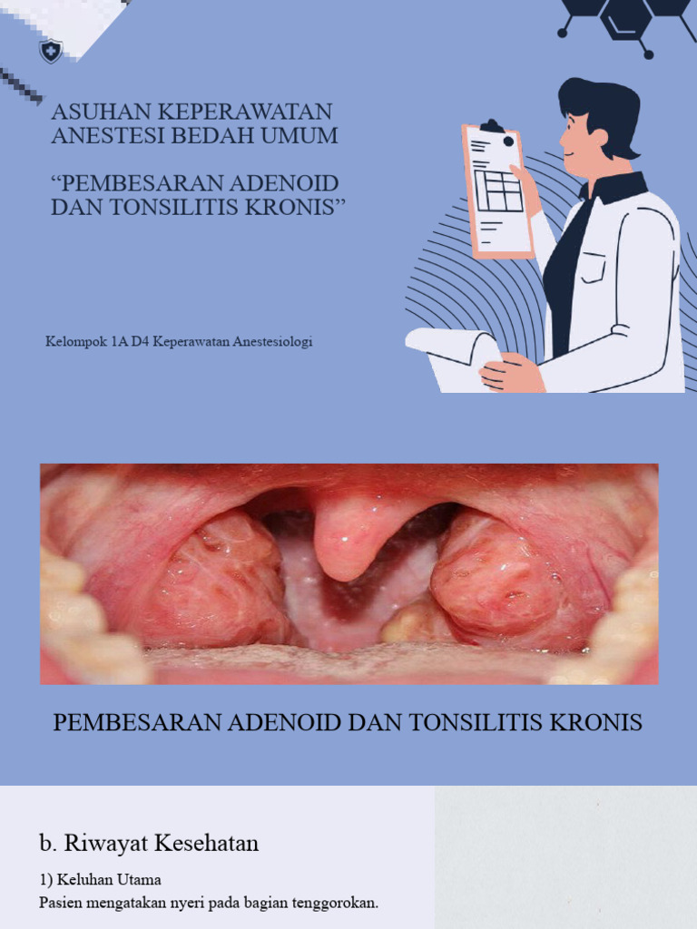 Ppt Askan Tonsilitis | PDF