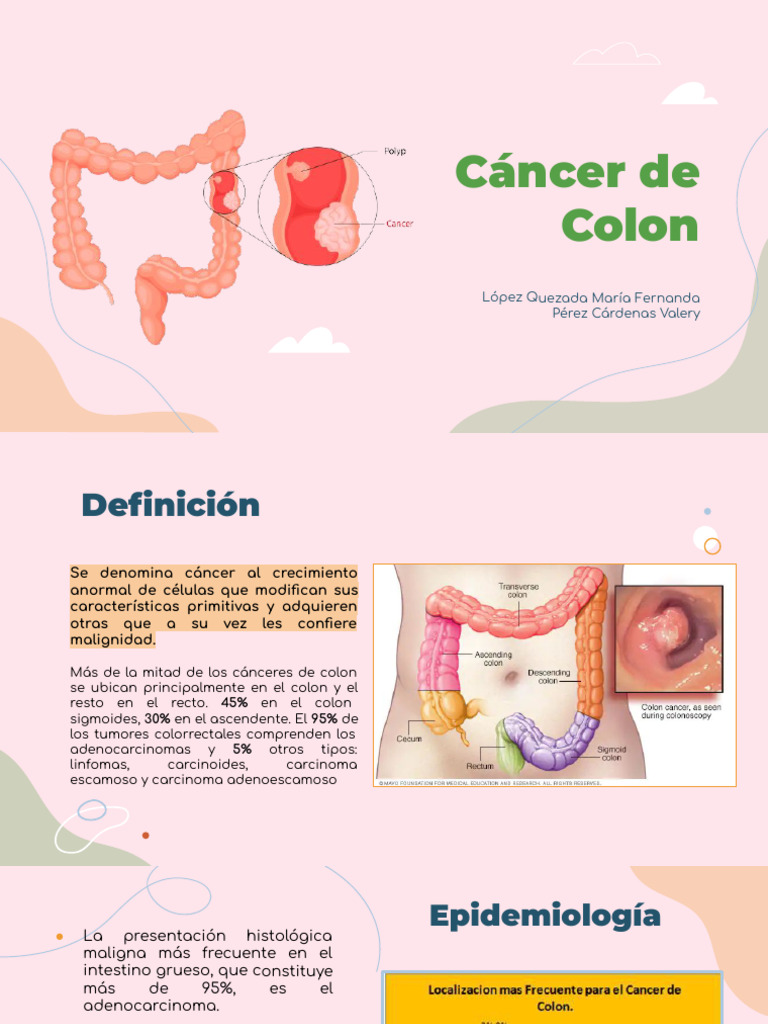 Cáncer de Colon: Definición y Epidemiología | PDF | Cáncer colonrectal ...