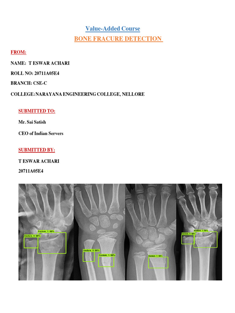 Bone Fracture Detection Pdf Machine Learning Artificial Intelligence