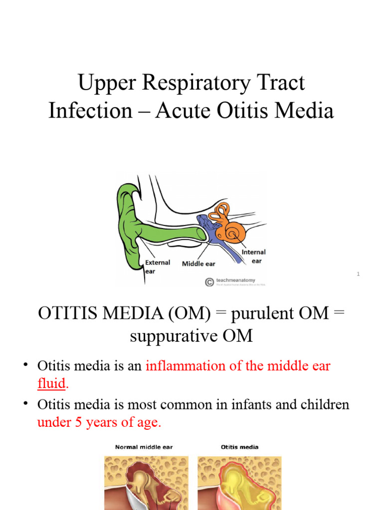 Acute Otitis Media 2023.2024 | PDF | Medicine | Health Sciences