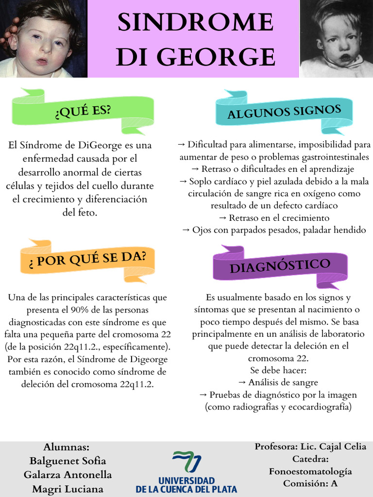 Sindrome de Digeorge | PDF