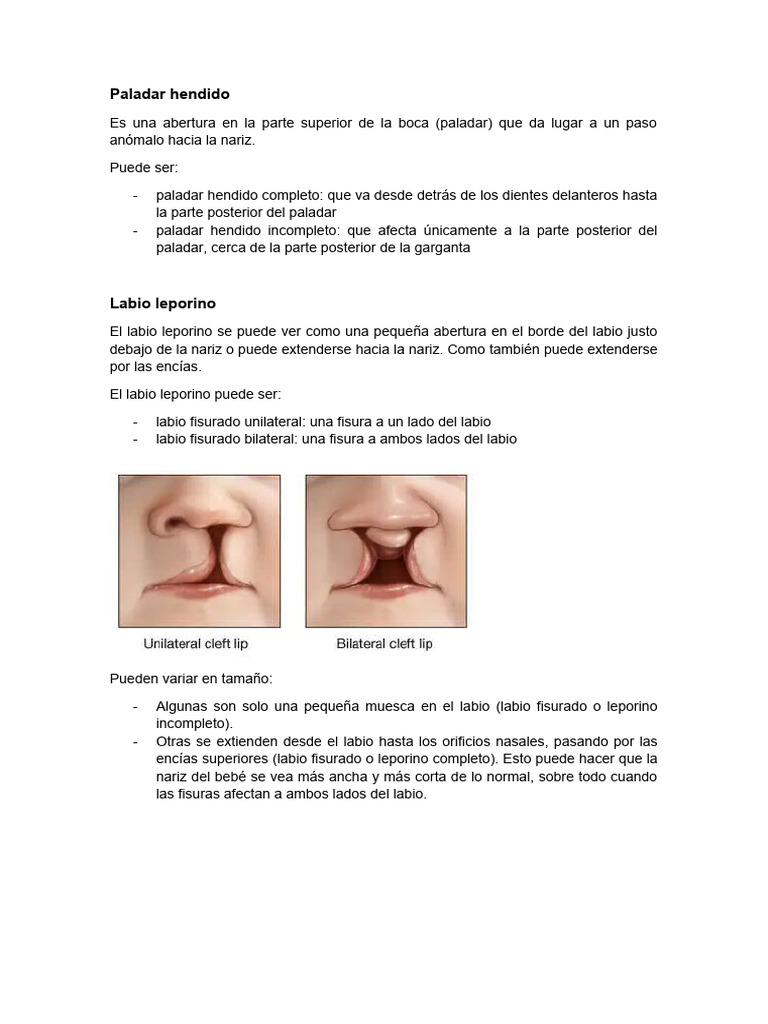 Labio Leporino y Paladar Hendido: Causas y Tratamiento | PDF | Causas ...