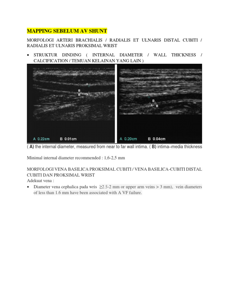 Mapping Sebelum Dan Sesudah Av Shunt | PDF