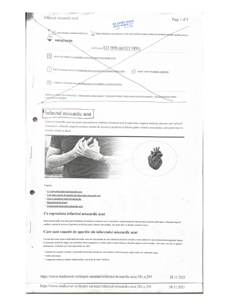 Infarctul Miocardic Acut | PDF