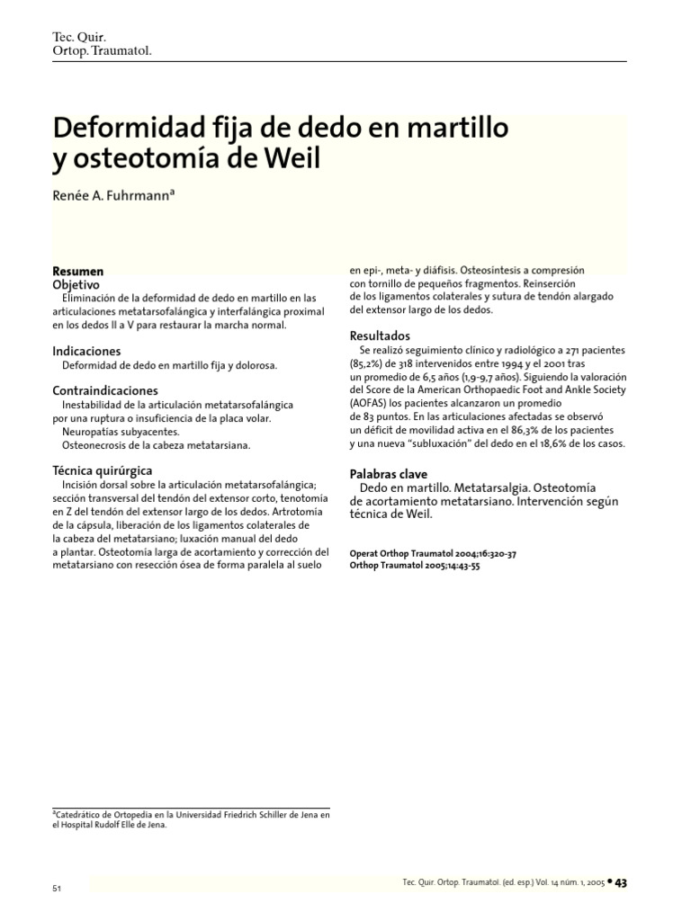 Deformidad Fija de Dedo en Martillo y Osteotomía de Weil: Renée A ...
