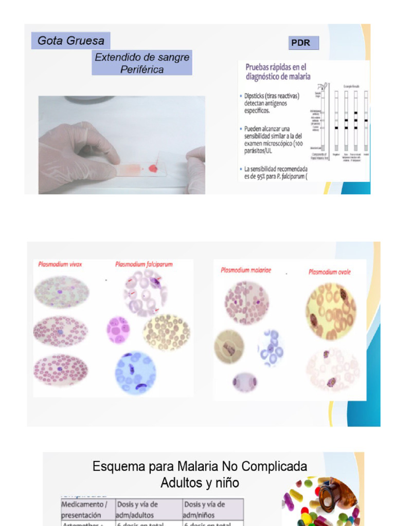 Esquemas de Tto de Malaria Cuarto Año Mic Ucs Lara | PDF