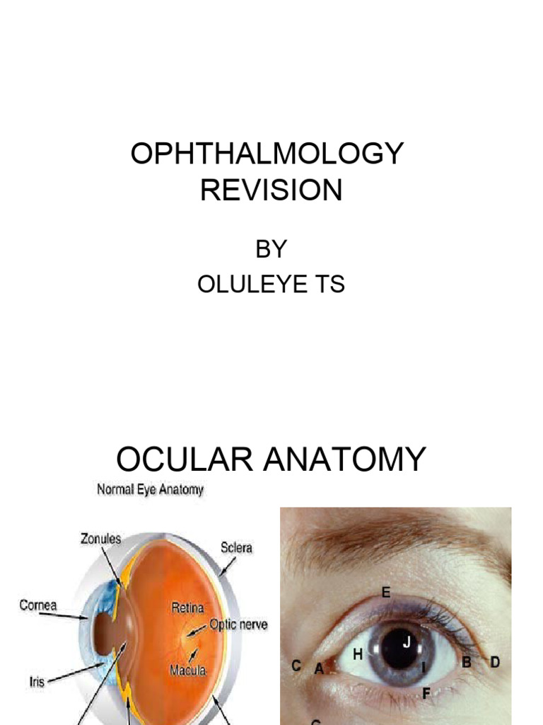 Paracentesis in Ocular Emergencies | PDF | Glaucoma | Ischemia
