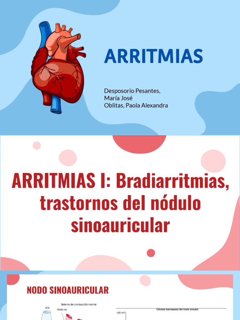ARRITMIAS.pptx (1) | PDF | Electrocardiografia | Electrofisiología cardíaca