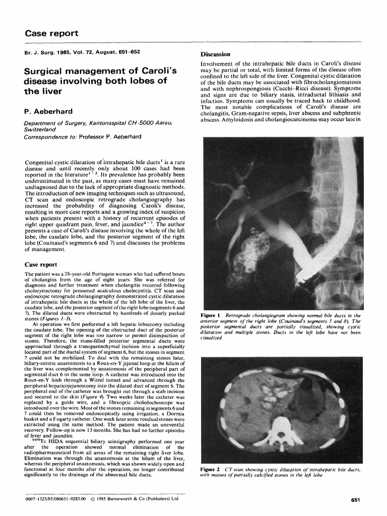 Surgical Management of Carolis Disease I | PDF | Digestive System ...