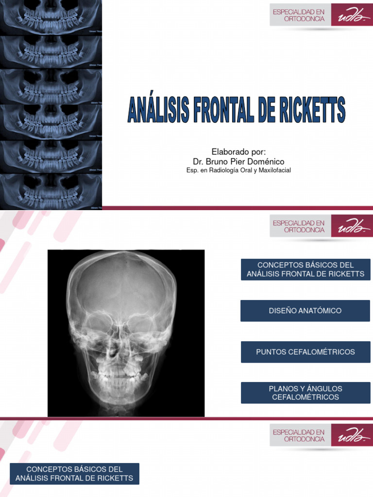 3.1. - Analisis Frontal de Ricketts | PDF | Anatomía humana | Sistema ...