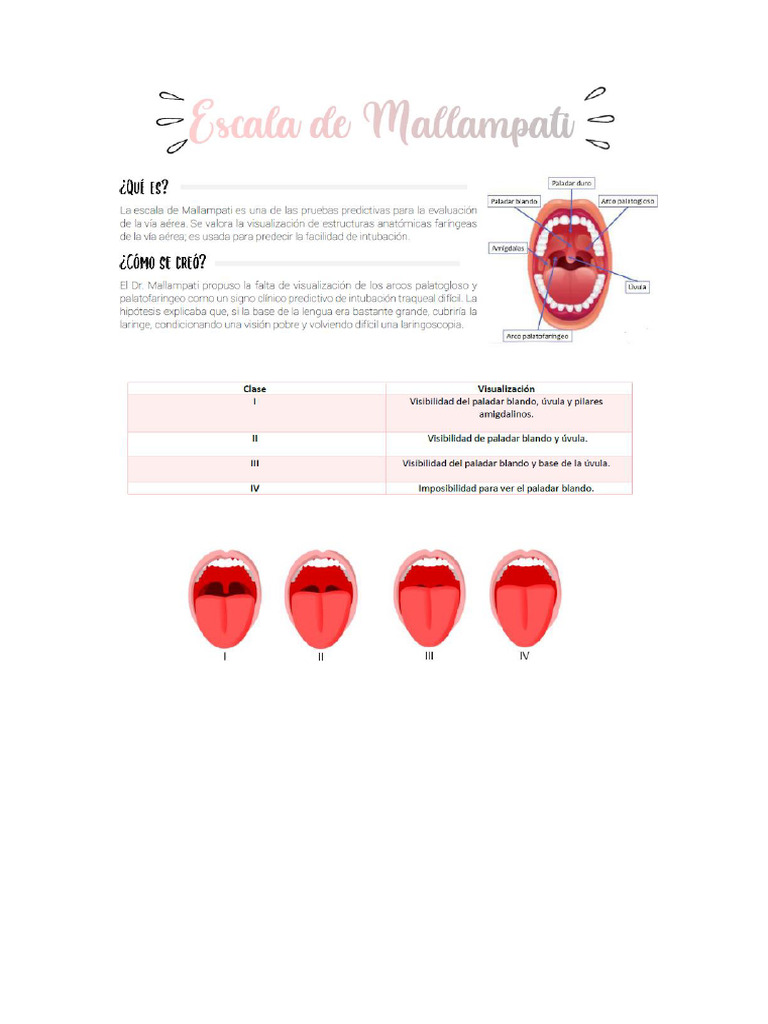 Escala Mallampati SS | PDF