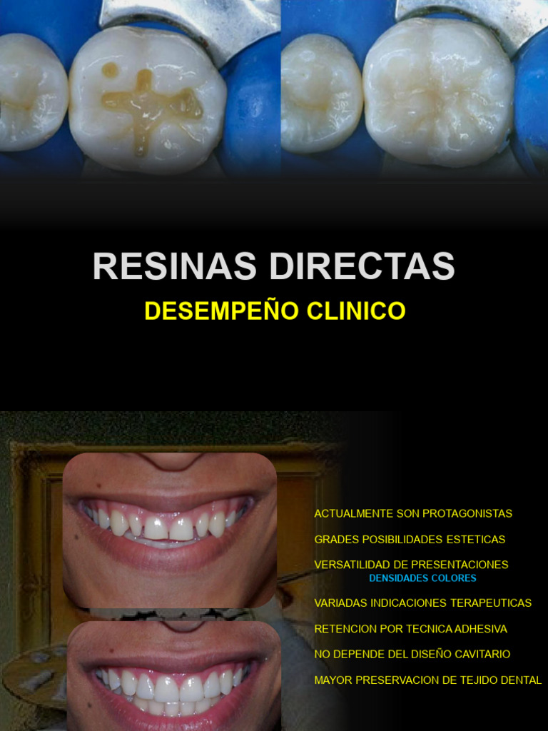 Desempeño Clínico de Las Resinas Compuestas Op PDF | PDF | Adsorción | Agua