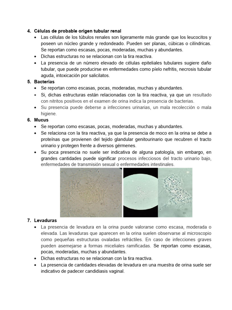 Análisis de Sedimento Urinario | PDF | Especialidades Medicas ...