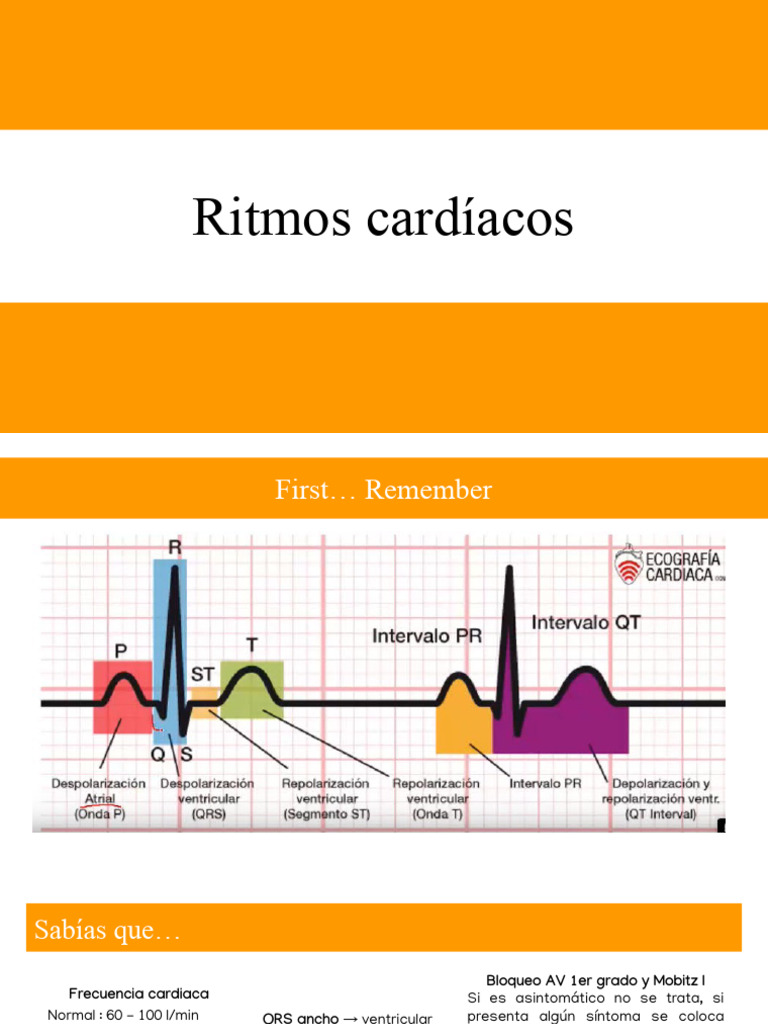 Ritmos cardíacos | PDF | Electrocardiografia | Arritmia cardiaca