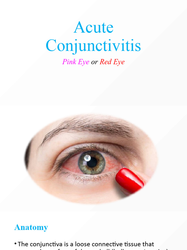 Acute Conjunctivitis | PDF | Causes Of Death | Ophthalmology