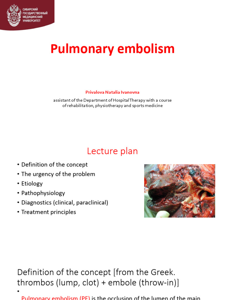 Pulmonary Embolism 2-1 | PDF | Thrombosis | Vein