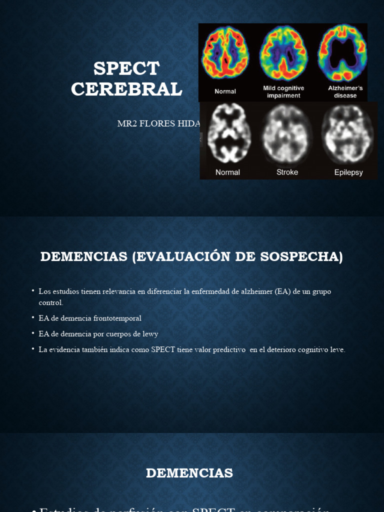 Demencias Adiccion y Spect | PDF | Demencia | Neurociencia