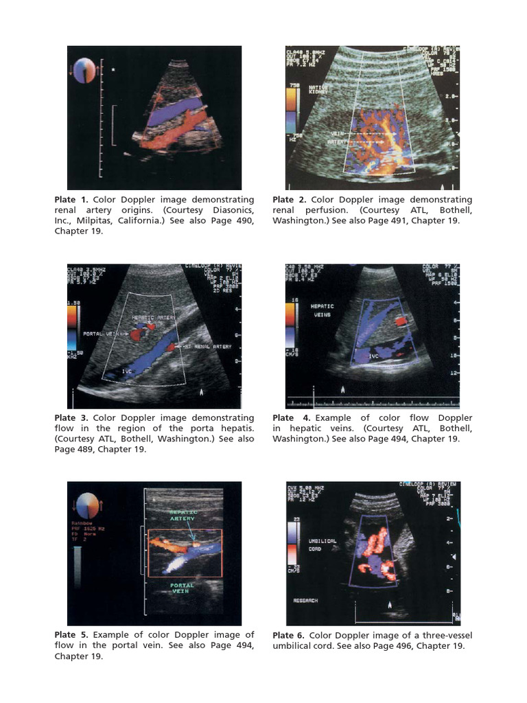 Diagnostic Ultrasound Color Plate | PDF | Cardiovascular System | Angiology