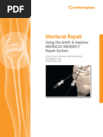 Swanson Toe Replacement | PDF | Toe | Foot