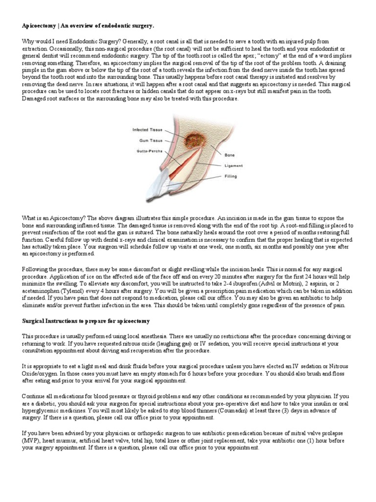 Apicoectomy - An Overview of Endodontic Surgery | PDF | Surgery | Dentistry
