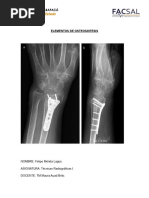 Materiales y tipos de osteosíntesis | PDF | Hueso | Tornillo