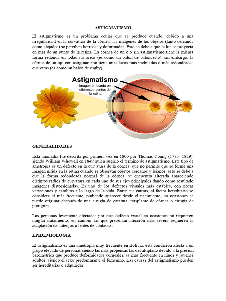 Astigmatismo Informe | PDF | Ojo humano | Oftalmología