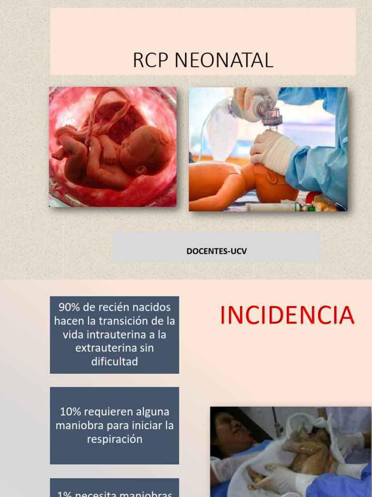 RCP Neonatal - Ucv | PDF | Reanimación cardiopulmonar | Feto