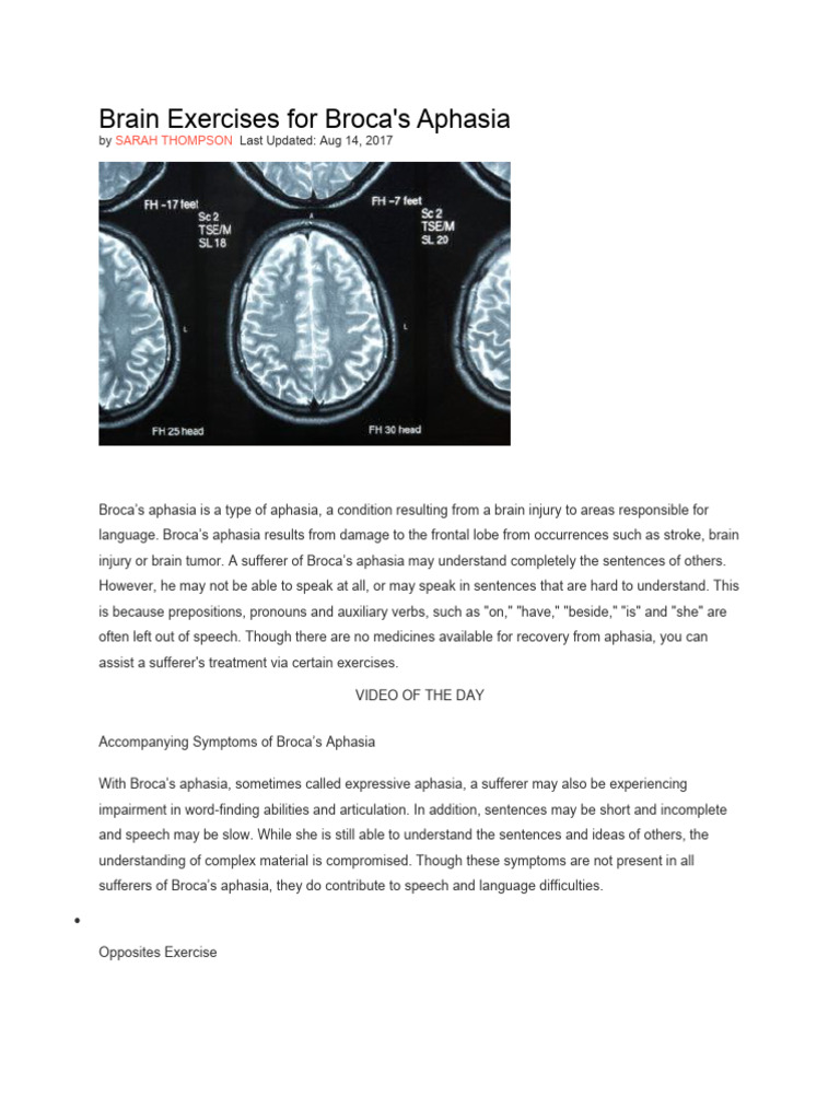 Brain Exercises for Broca's Aphasia | PDF | Aphasia | Speech
