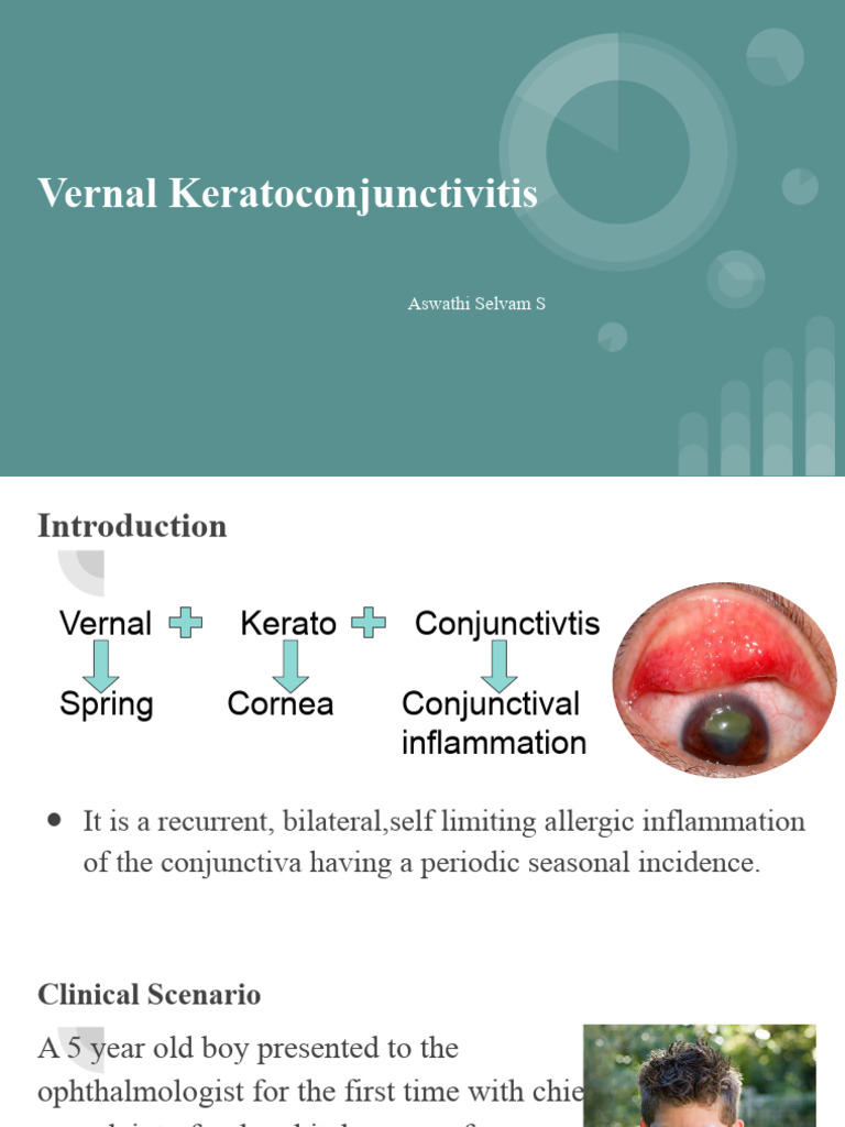 Understanding Vernal Keratoconjunctivitis | PDF | Diseases And ...