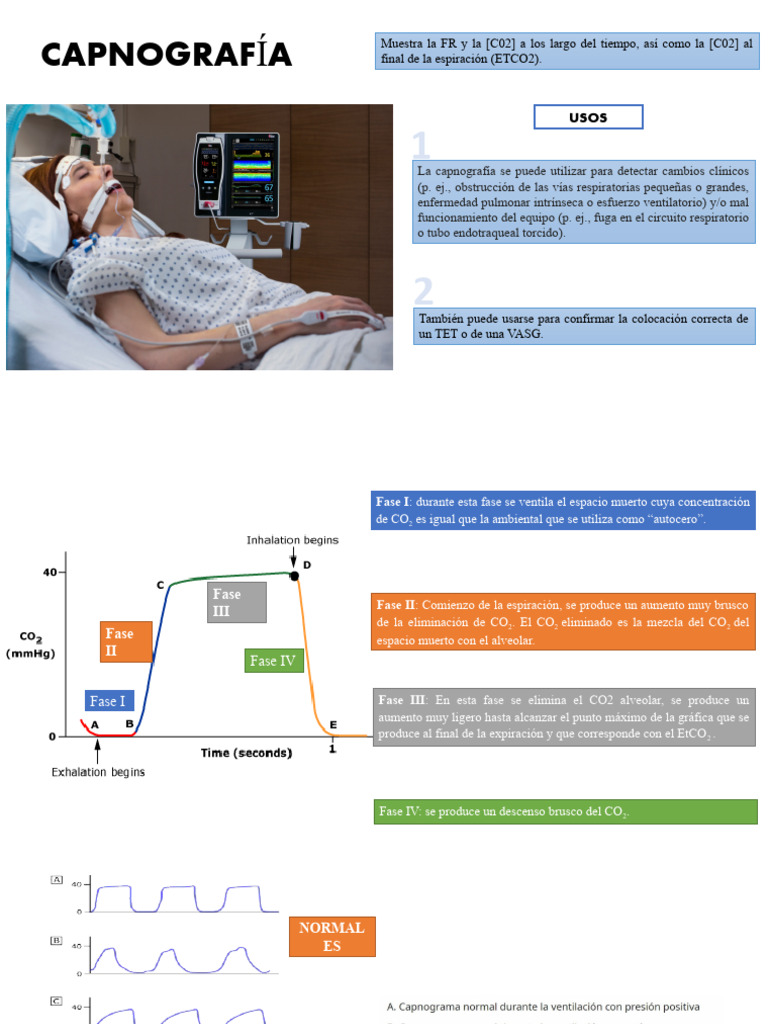 CAPNOGRAFÍA | PDF