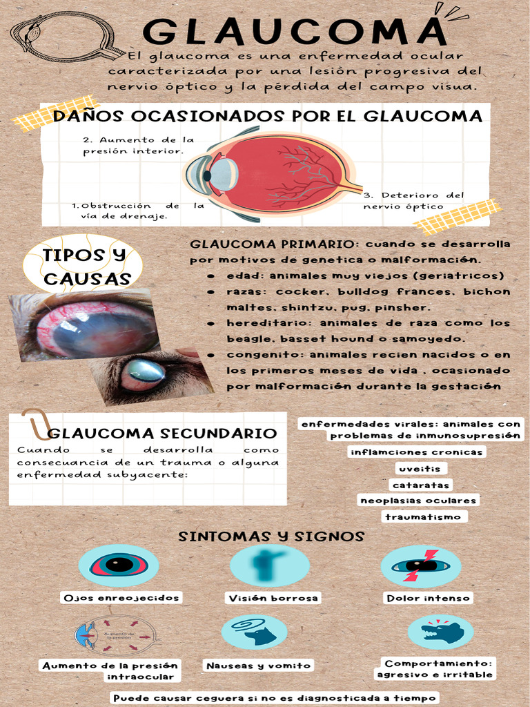 Glaucoma | PDF | Glaucoma | Ojo humano