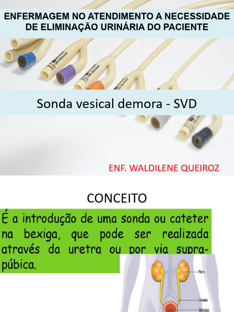 Sonda Vesical Demora - SVD | PDF | Aparelho geniturinário | Urologia