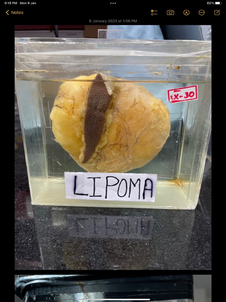 Pathology Gross Specimens-1 | PDF